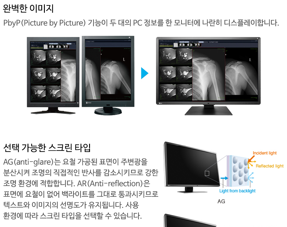 에이조 EIZO RadiForce RX660 - 판독용모니터(컬러 6mp) : 네이버 블로그